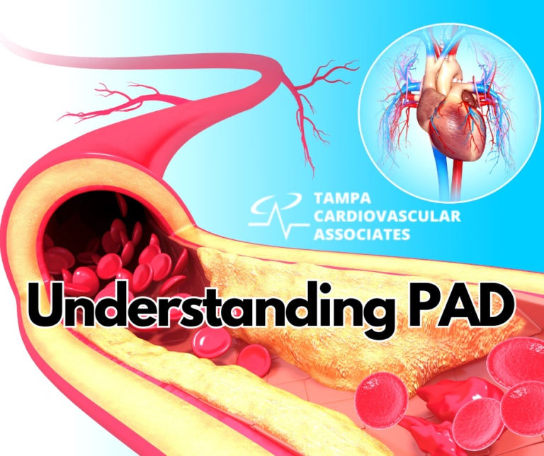 Living with Peripheral Artery Disease | West Fl Vascular